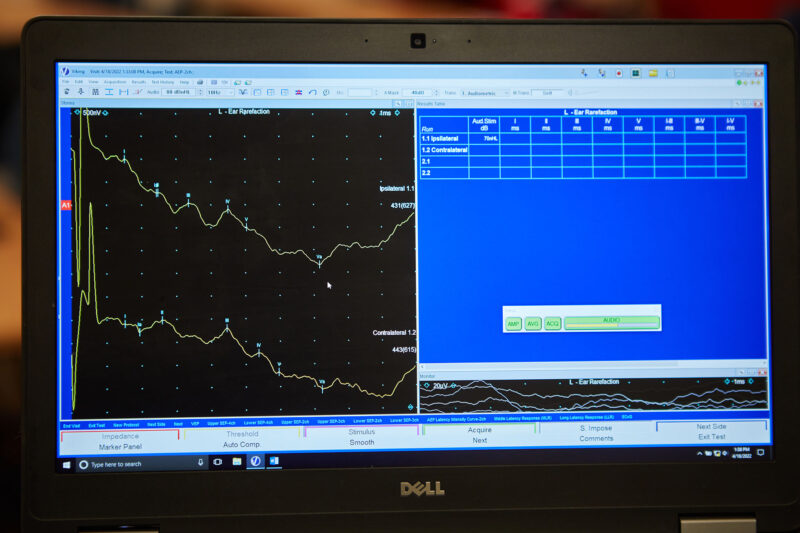 Unlocking the Mind: Understanding the Brain Waves Measured by an EEG